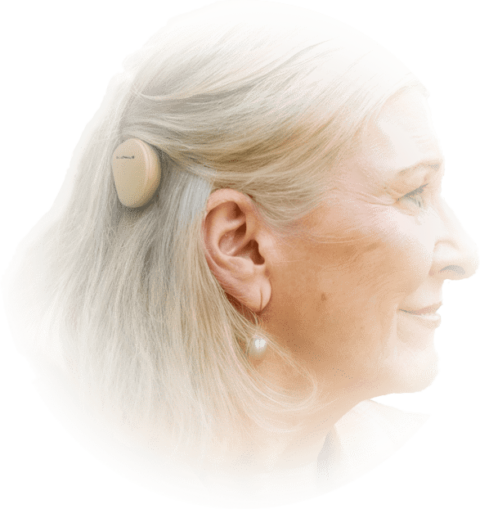 Cochlear Implants - Capital Institute of Hearing & Balance